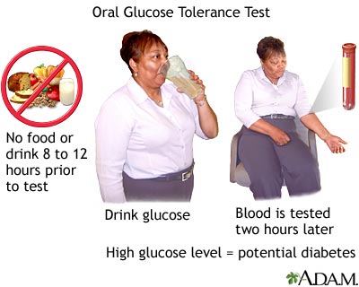Glucose Intolerance Test? | Diabetes Healthy Solutions